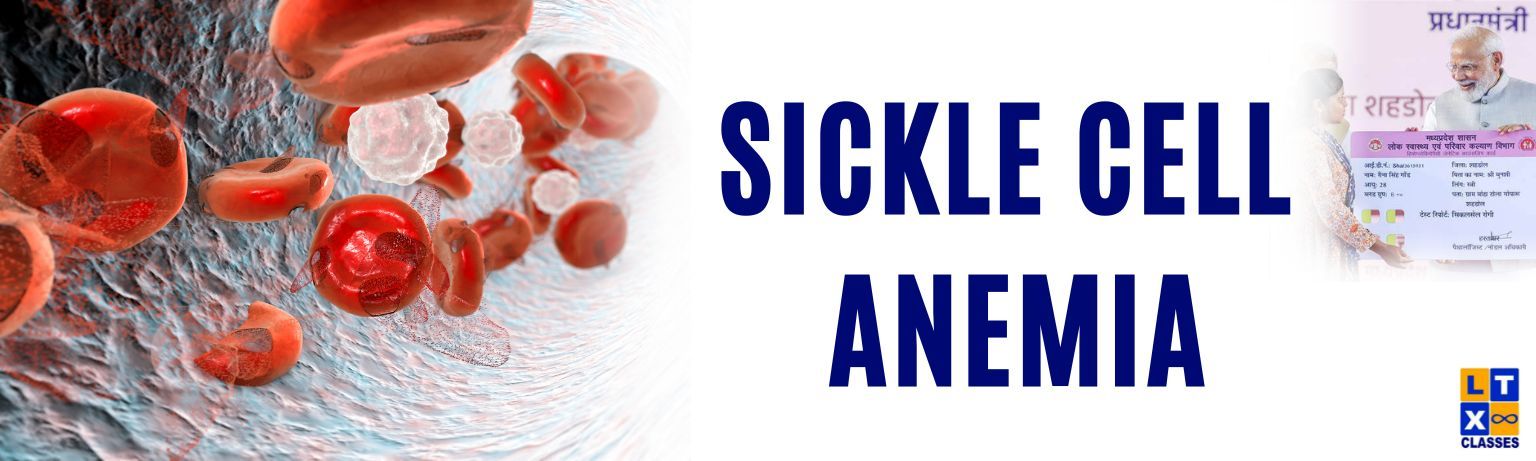 Sickle Cell Anemia 1550
